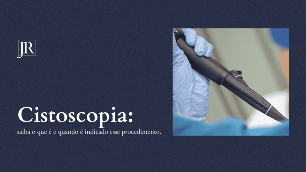 Cistoscopia: saiba o que é e quando é indicado esse procedimento - Dr ...